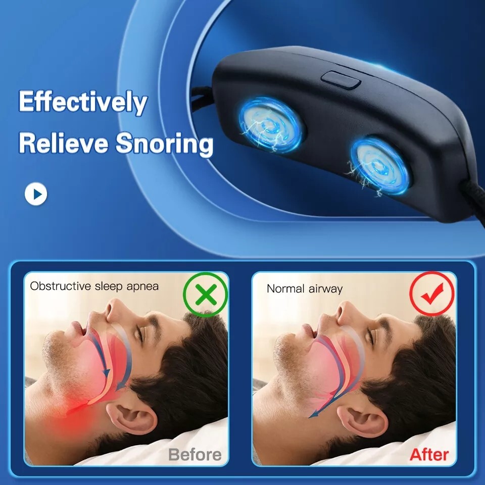 Electric Smart Anti Snoring Pulse Device Comfortable Sleep Well Snoring ...