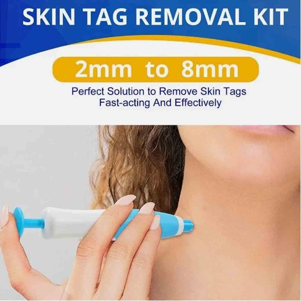 2-in-1 Micro Auto Skin Tag Remover Pen Tool Kit Painless Wart Skin Tag ...