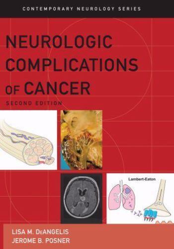 Neurologic Complications of Cancer by Deangelis, Lisa M.; Posner ...
