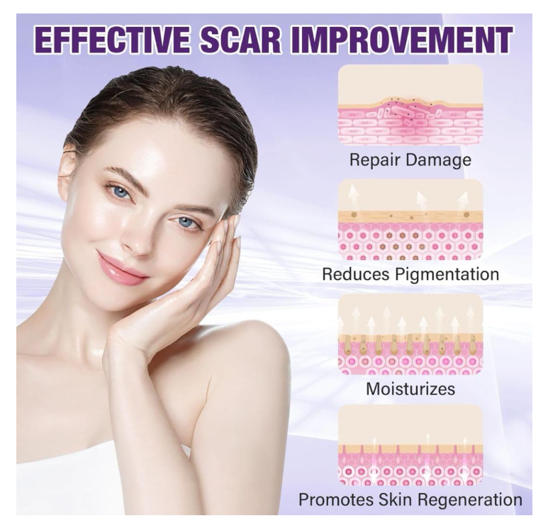 Scar Cream,Scar Gel,Scar Cream For Surgical Scars,Scar Removal Cream ...