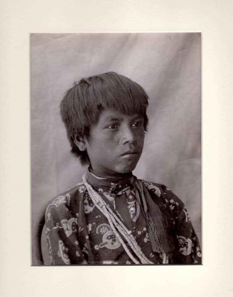 ORIGINAL ~ c.1900 BEAUTIFUL NATIVE AMERICAN BOY WITH MEASLES SCARS ...