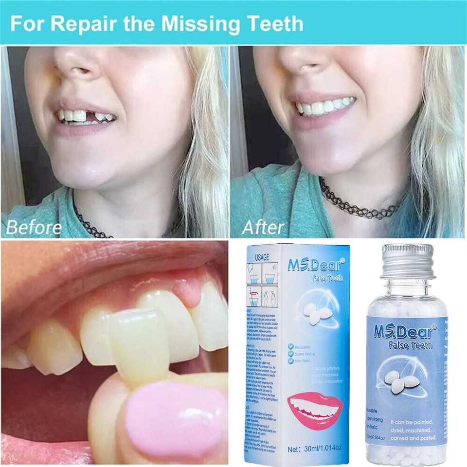 Temporary Strong Teeth Tooth Repair Dental Cement Cavity Filling Kit ...