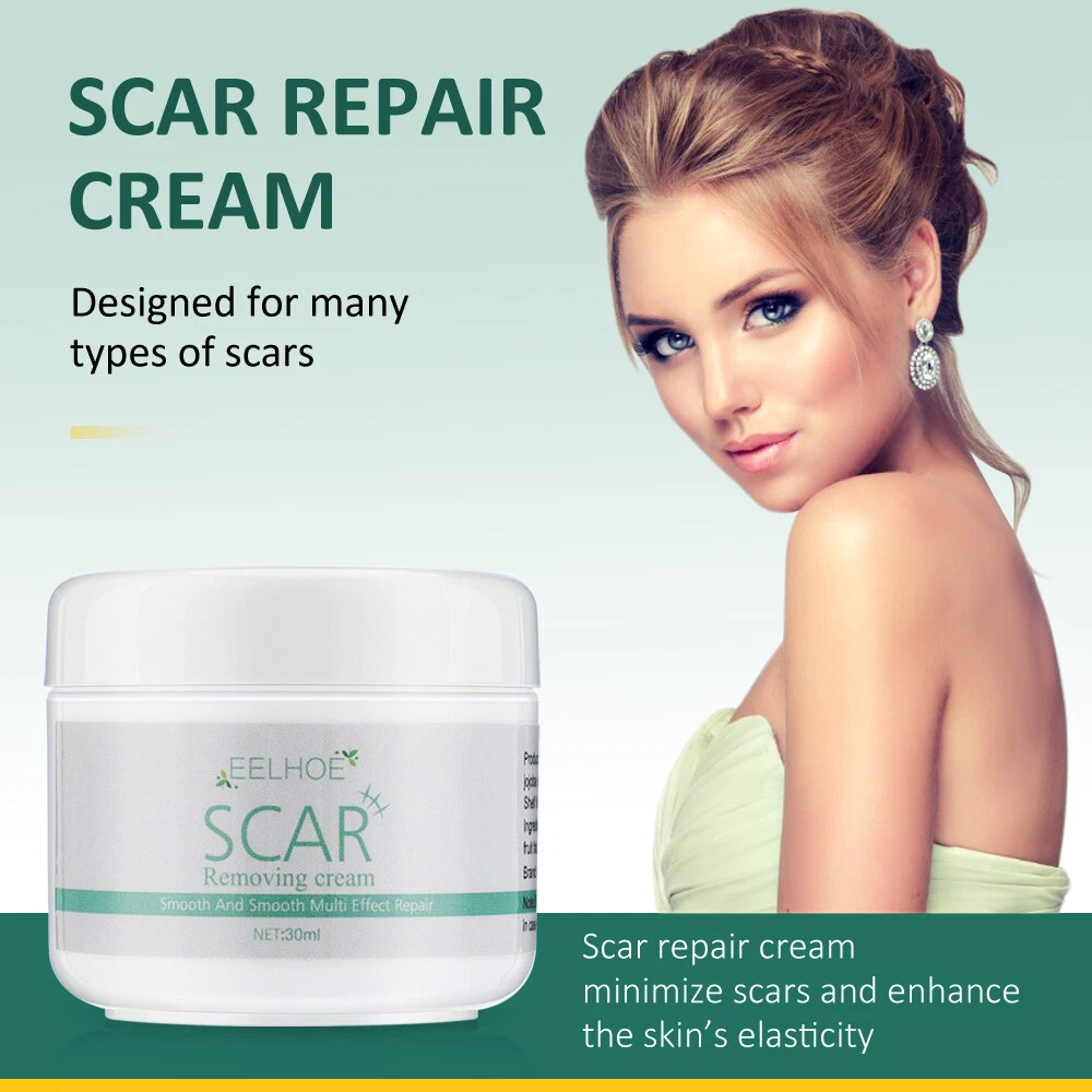 Aloe Vera Lotion For Scars