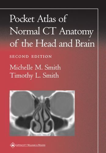 Pocket Atlas of Normal CT Anatomy of the Head and Brain (Radiology ...