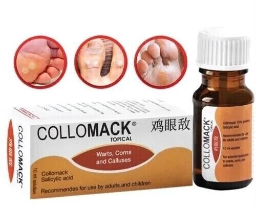 2 Box Collomack Topical Painless Remover Plantar Warts Corns And ...