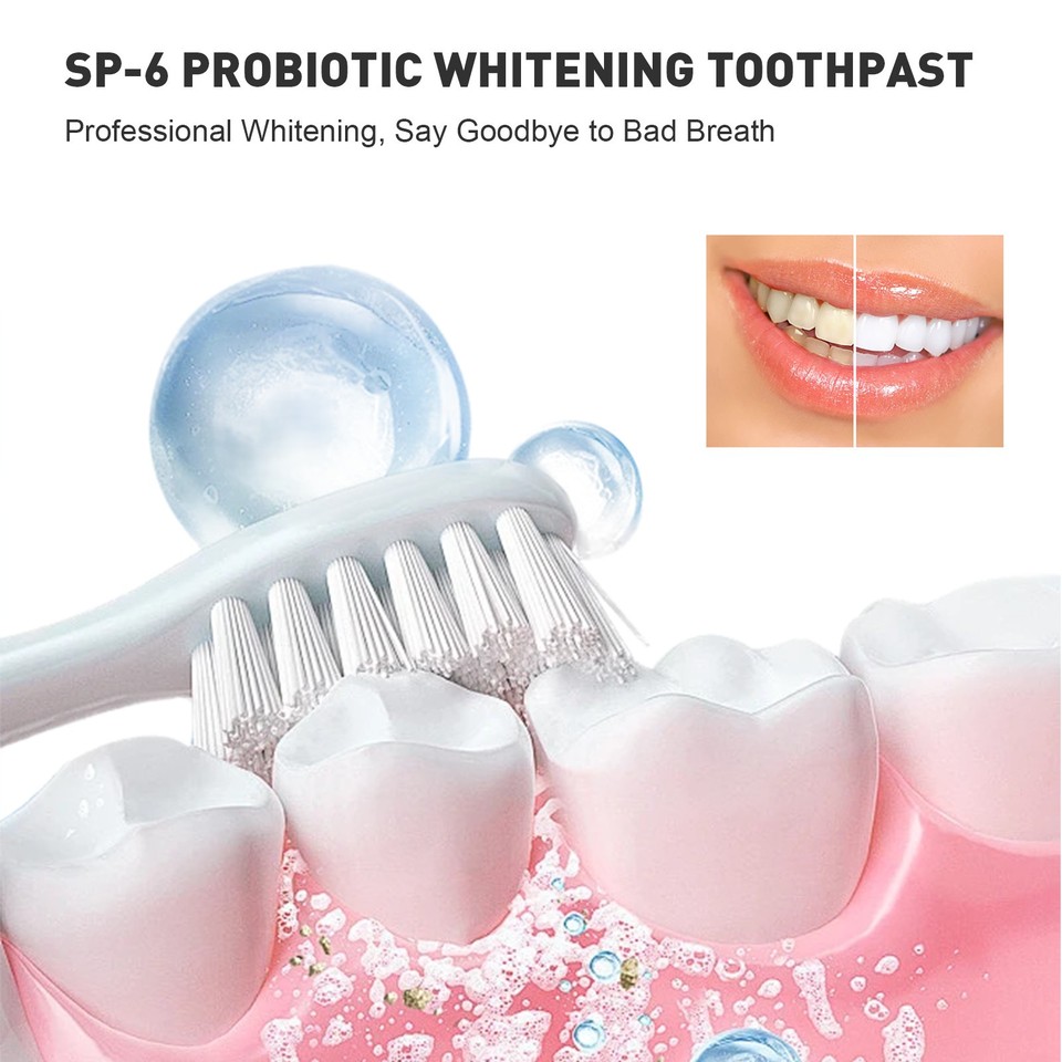 SP-6 Probiotic Toothpaste,Sp-6 Toothpaste Whitening Quick White ...