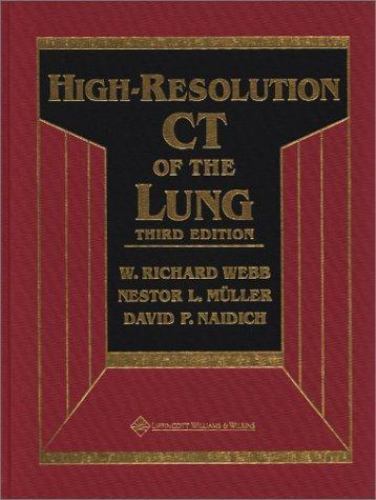 High-Resolution CT of the Lung by Nestor L. Müller, David P. Naidich ...
