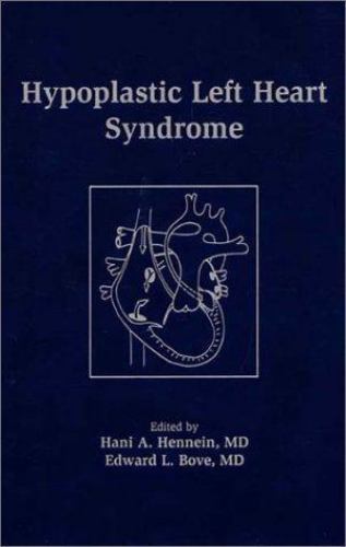 Hypoplastic Left Heart Syndrome by Edward L. Bove (2002, Hardcover) for ...