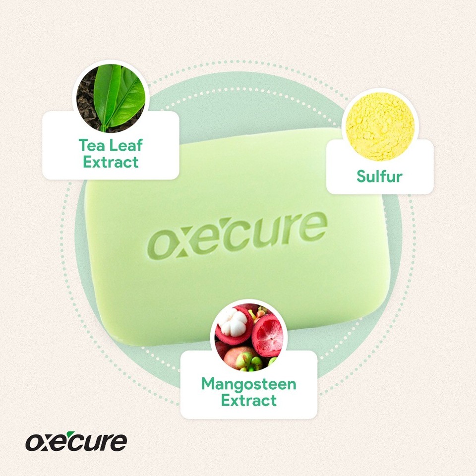 Big size 100g x 2 Oxe Cure Sulfur Soap for Face, Body Oily Acne Prone ...