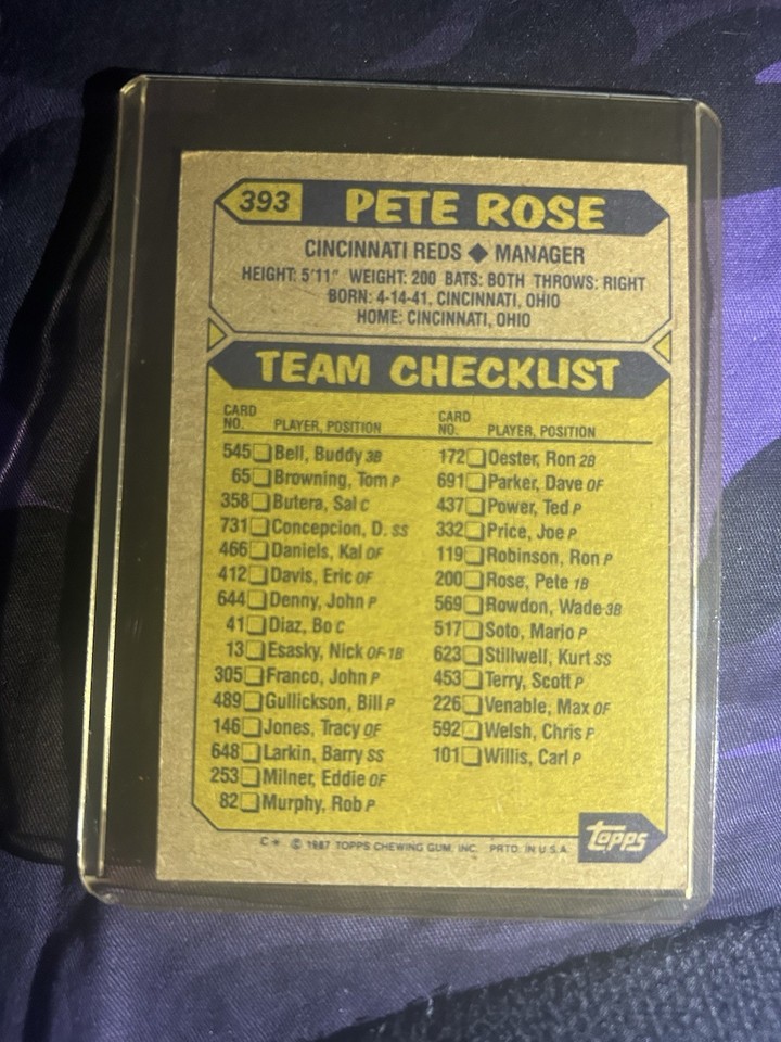 1987 Topps - Pete Rose #393 Error Card | eBay