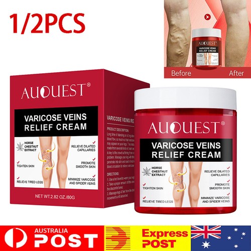 1/2x Veins Relief Varicose Cream Phlebitis Angiitis Vein Inflammation ...