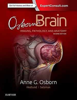 Osborn's Brain - Hardcover, by Osborn MD FACR Anne G. Hedlund DO Gary L ...