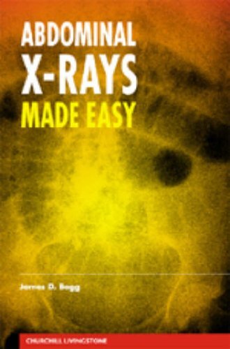 Abdominal X-Rays Made Easy By James D. Begg MB BS FRCR Dr. 9780443062056 | eBay