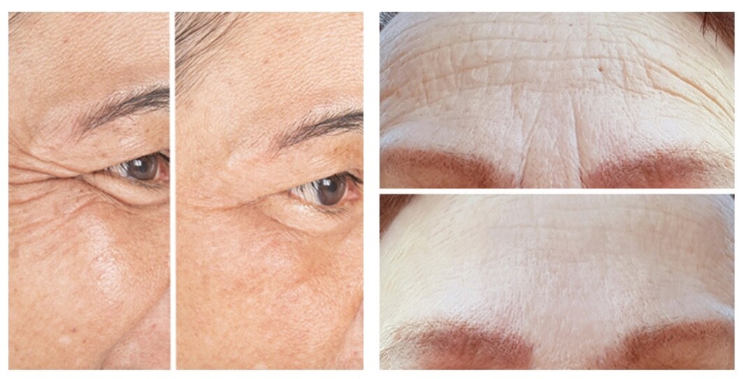 Derm Le Mar Anti Aging Serum 1oz Reduces Wrinkles *AUTHENTIC* 2 MONTH ...