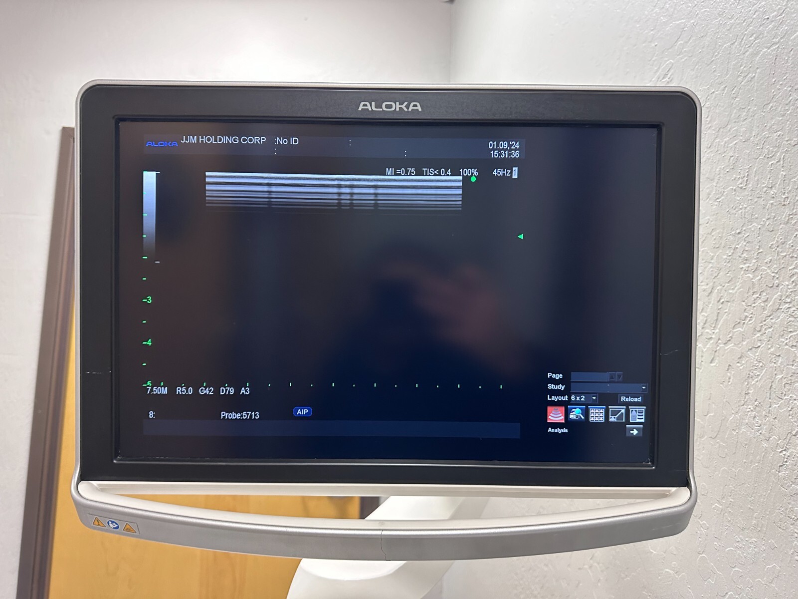 ALOKA PROSOUND F75 PREMIER ULTRASOUND SYSTEM | eBay