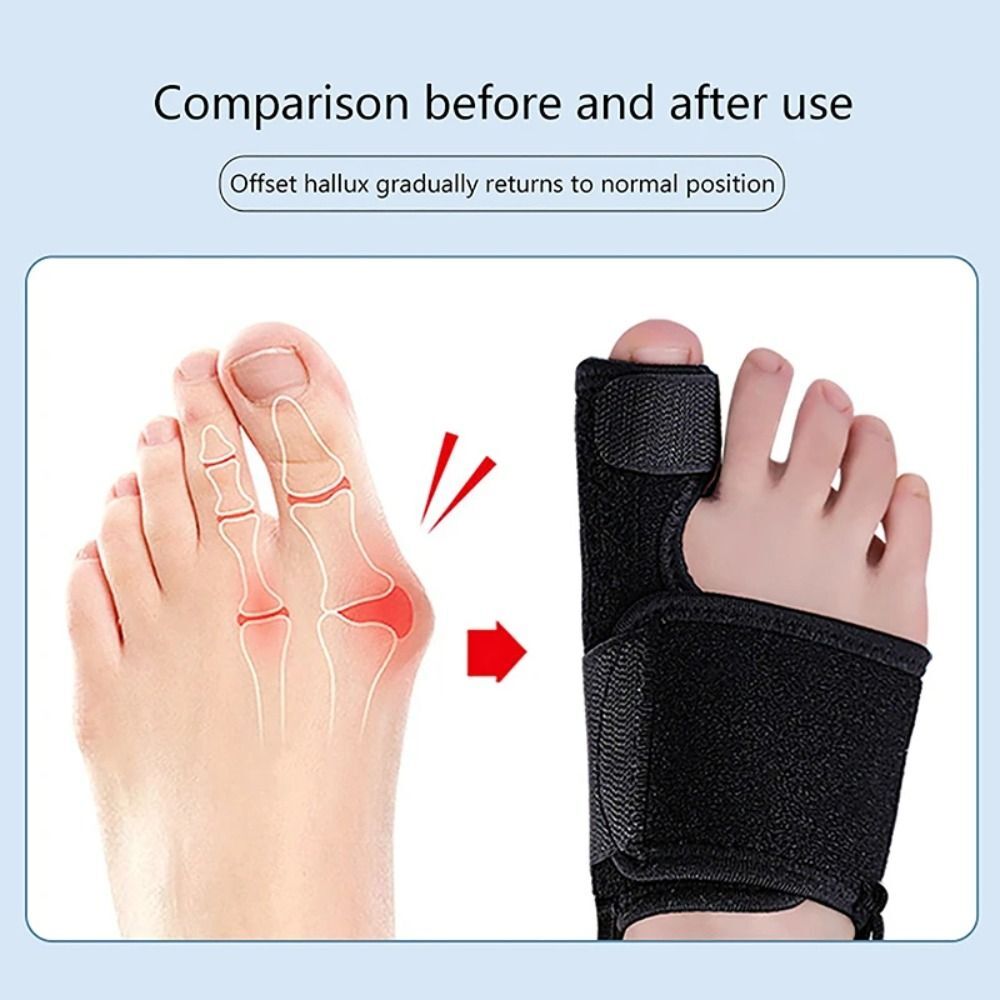 Orthotics Big Toe Bunion Protector Hammer Protector Bunion Corrector ...