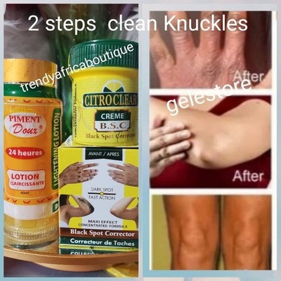 2pcs. Pment Exfoliating hand Cleanser & Citroclear. Hand, Feet ...