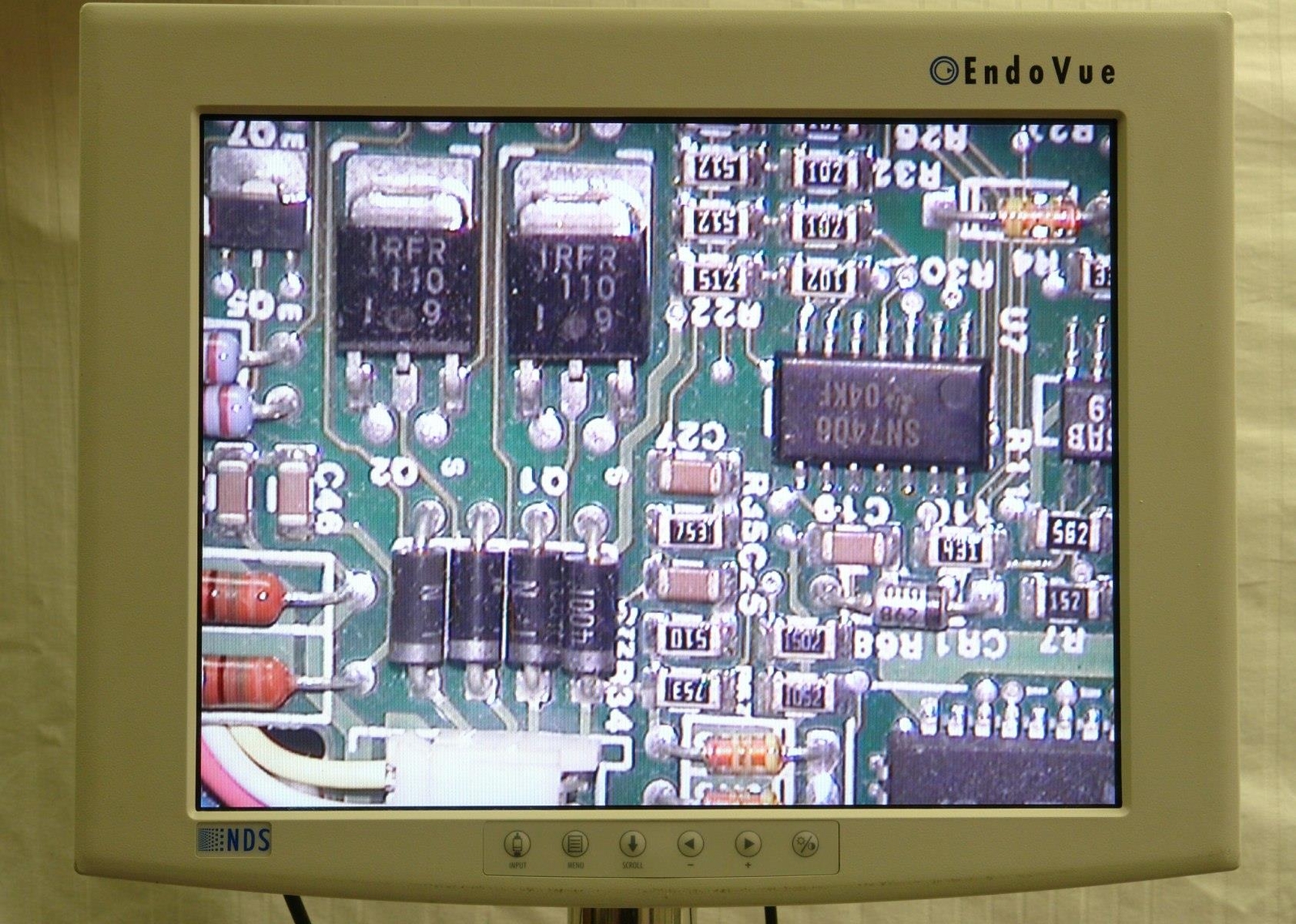 Kappa DVC750 Video Processor Medical Colposcope Stack Endovue Monitor ...