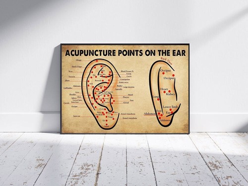 Acupuncture Points On The Ear Knowledge Poster Unframe Vintage Print | eBay
