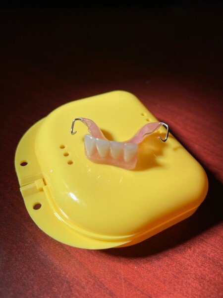 CUSTOM MISSING TEETH FLIPPER/ StayPlate for Upper Lower (Hard Acrylic ...