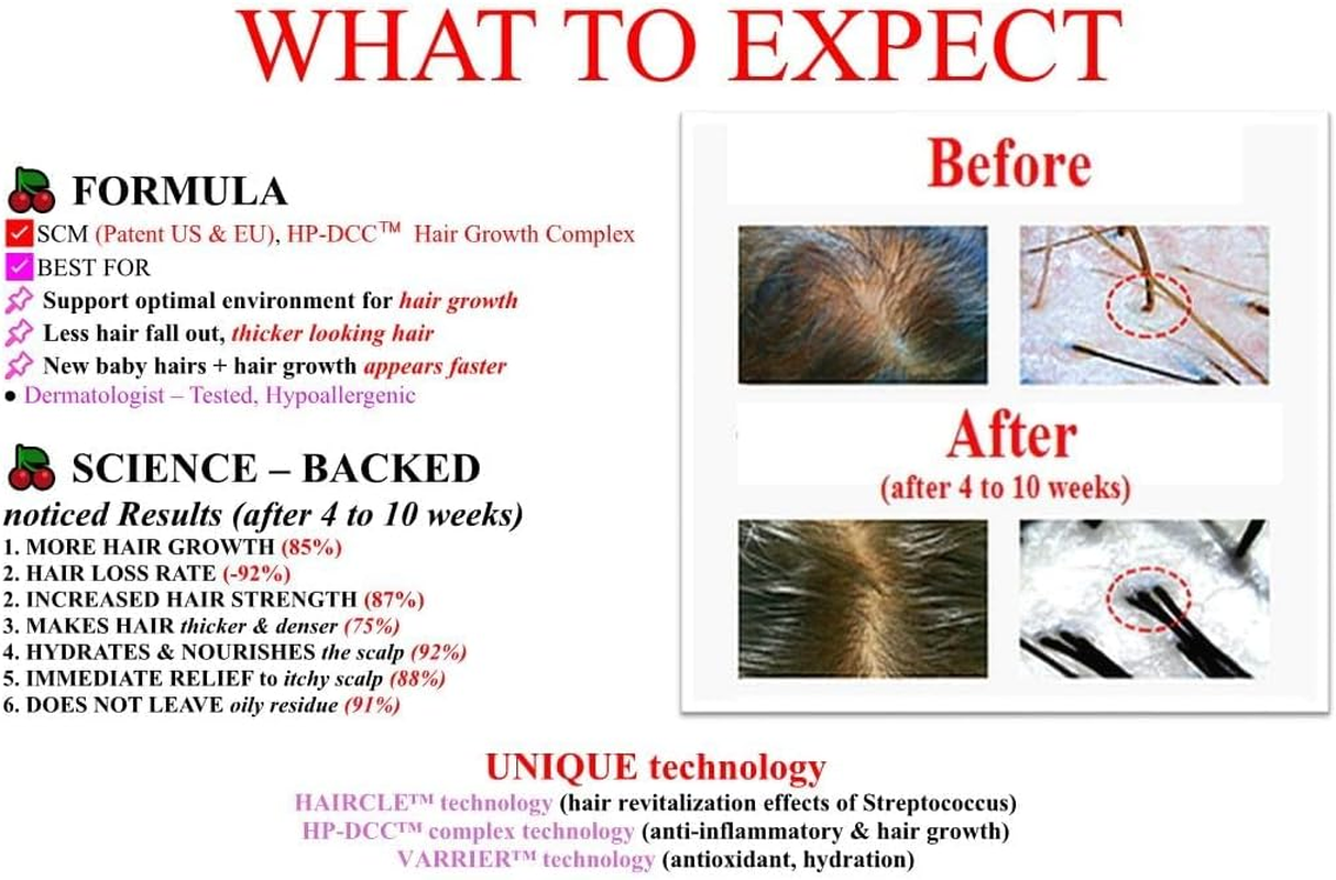 [SCM+HGF Effect] the SCM Hair Scalptonic & Serum┃Boost Hair Growth ...