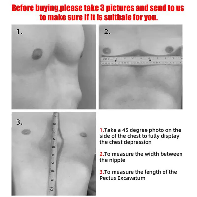 Hot Pectus Excavatum Orthosis Brace Sternal Depression Sternum ...