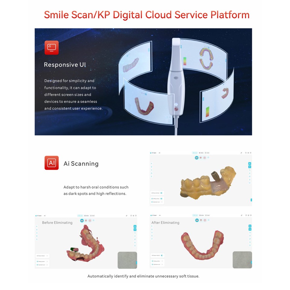 Woodpecker Smile Scan Dental 3D Intraoral Scanner Digital Impression ...