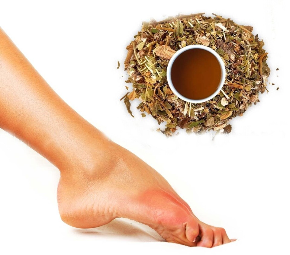 Herbal tea mixture for Gout, bulk, Gout tea | eBay