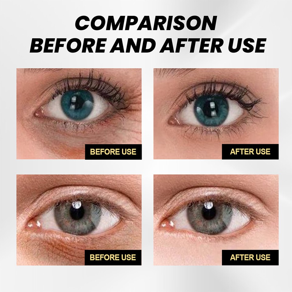 Temporary Eye Tightener Eye Cream, Instant Reduces Under-Eye Bags, Dark ...