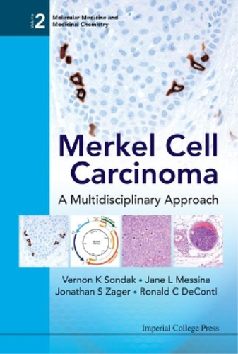 Ronald C Deconti Merkel Cell Carcinoma: A Multidisciplinary Approach ...