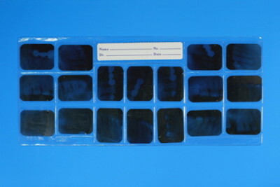 Dental Full Mouth Mount (FMX) X-Ray Film Mounts CP12H6V | eBay