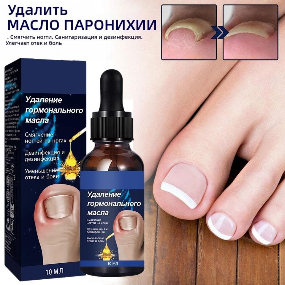 Cure Ingrown Toenail Treatment Infection Nail Care Oil δ Paronychia ...