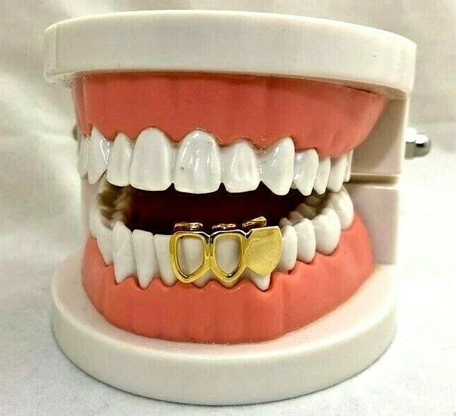 Open Face Gold Tooth Cap
