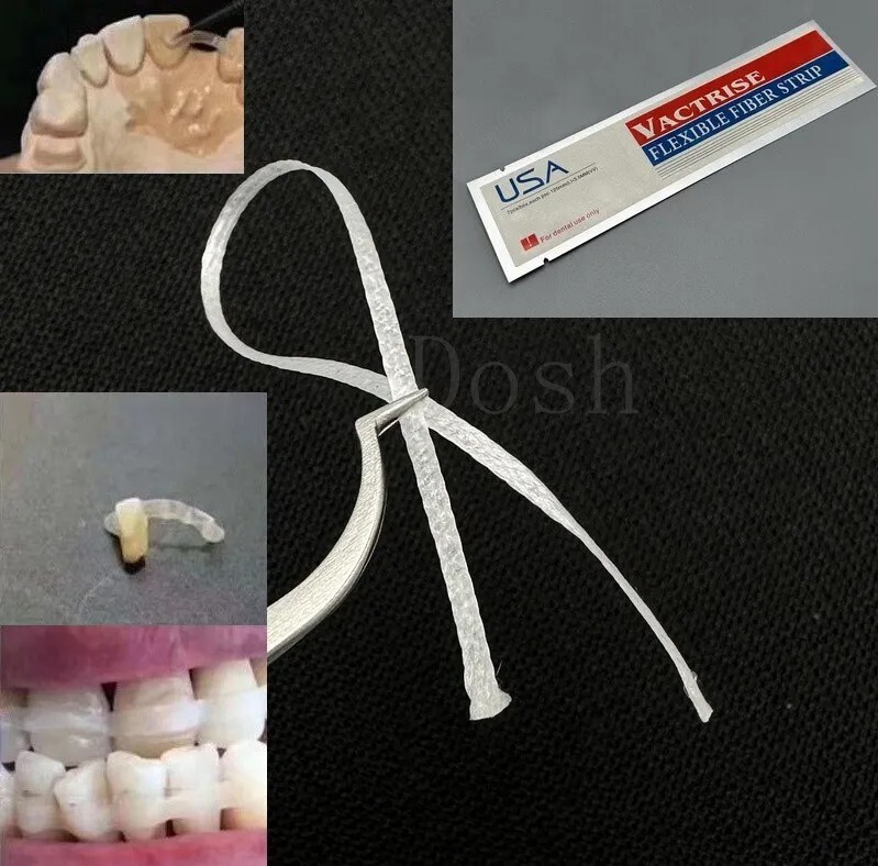 7pcs Dental Glass Fiber Strip 3.5 Light Cure Bonding Vactrise Splint ...