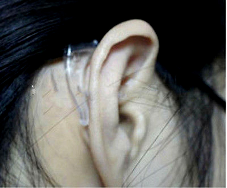 5 Pairs of Ear Back Holders_Your Glasses'll Never Slide Down ...