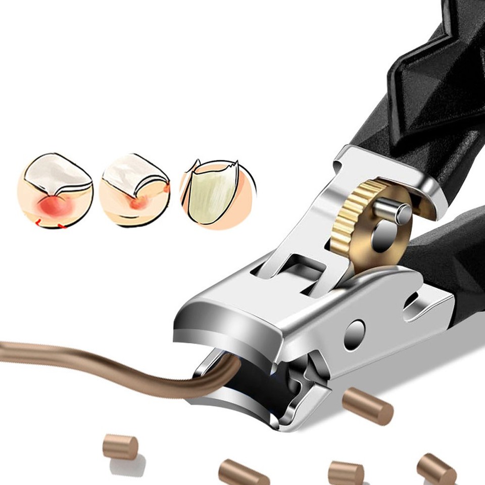 Funfany Orthoclip, Zoerely Orthoclip, Graddi Ortho Clip, Thick Toenail ...