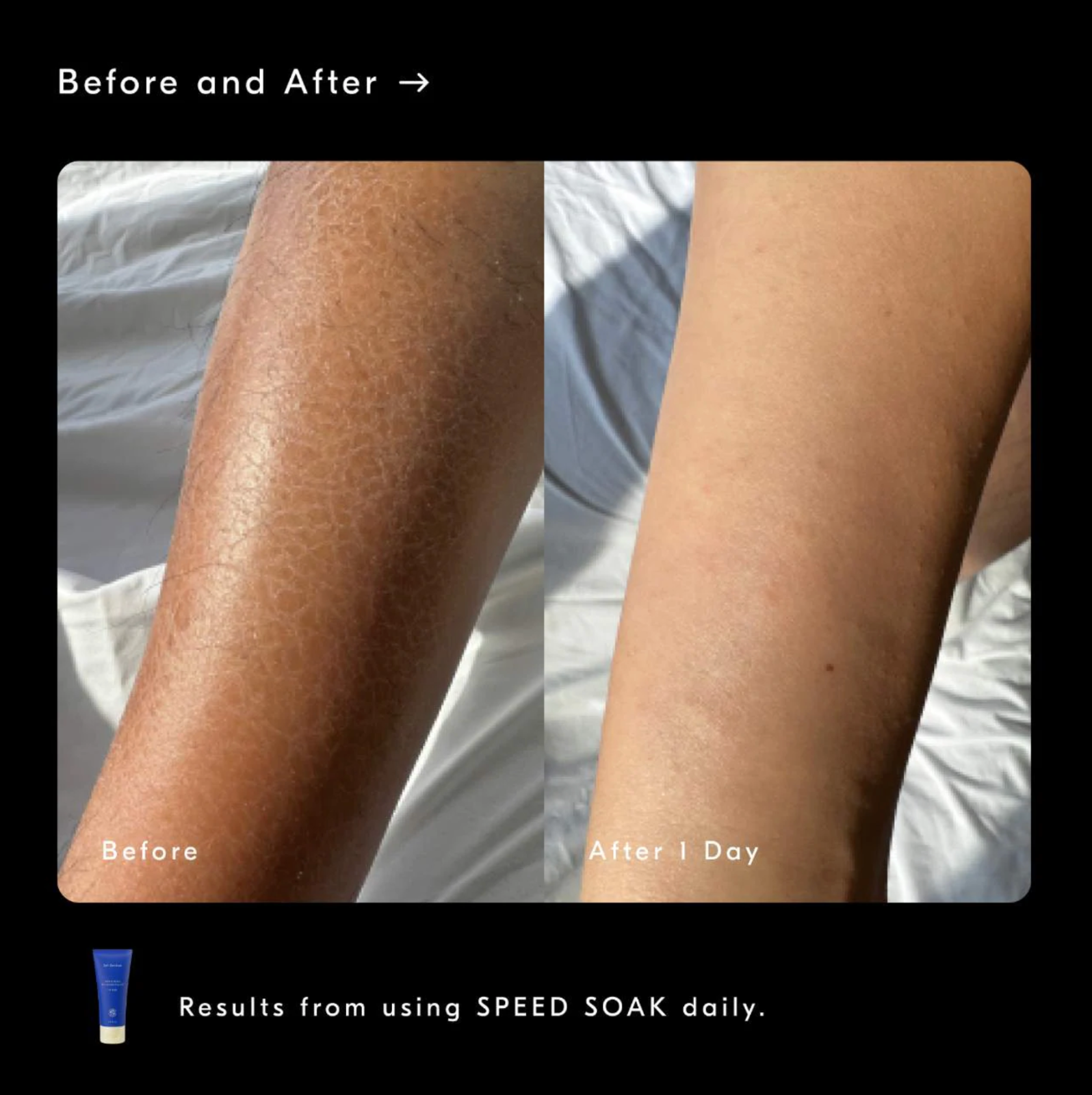 Soft Services The Body Skin Experts Bestsellers Discovery 3-Step Body ...