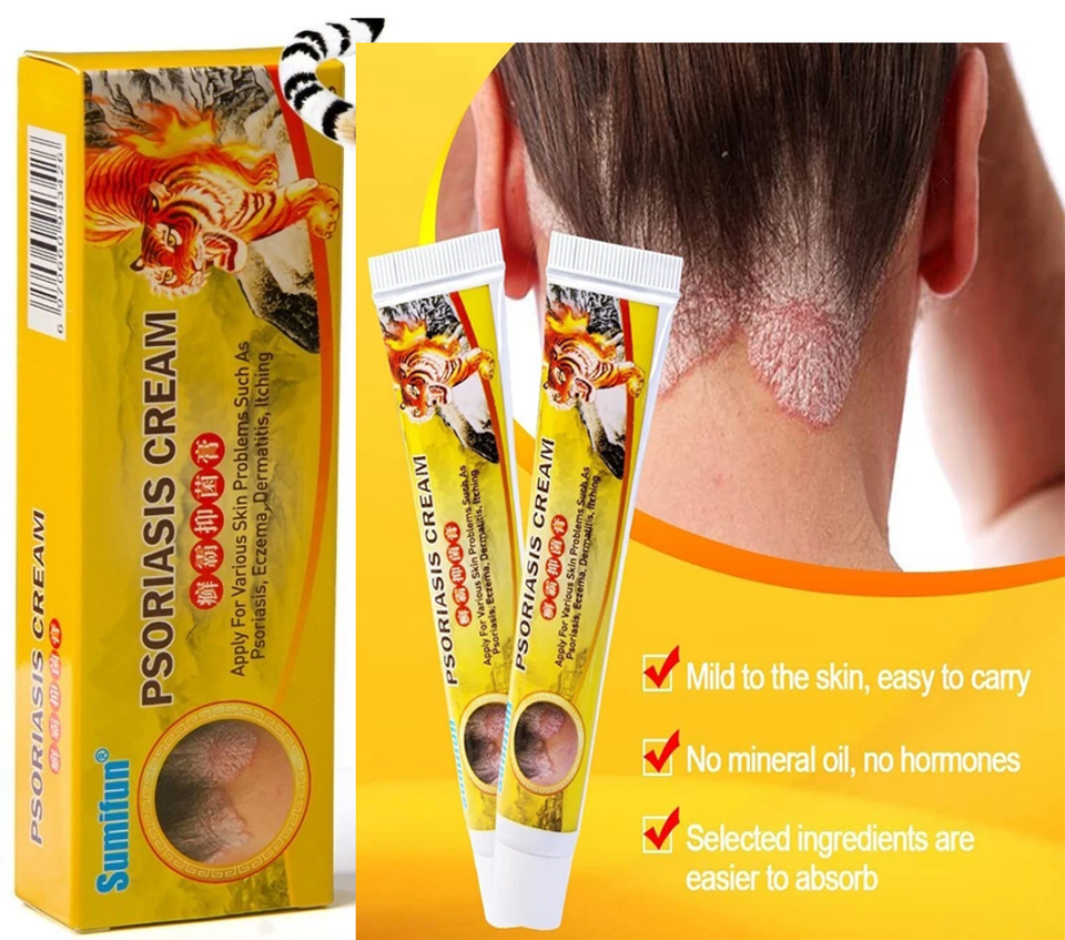 Full Body Health Care Psoriasis Cream Eczema Ointment Scalp Psoriasis ...