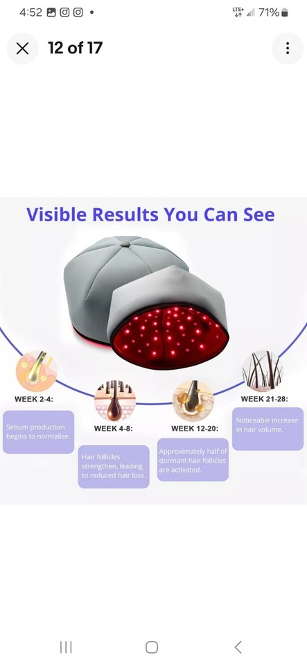 Red Light Therapy Cap LED Infrared Laser Hair Growth Hat Helmet Loss ...