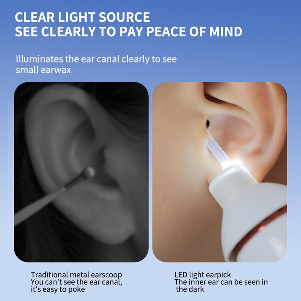 Electric LED Light Ear Wax Removal Kit Automatic Ear Vacuum Cleaner ...