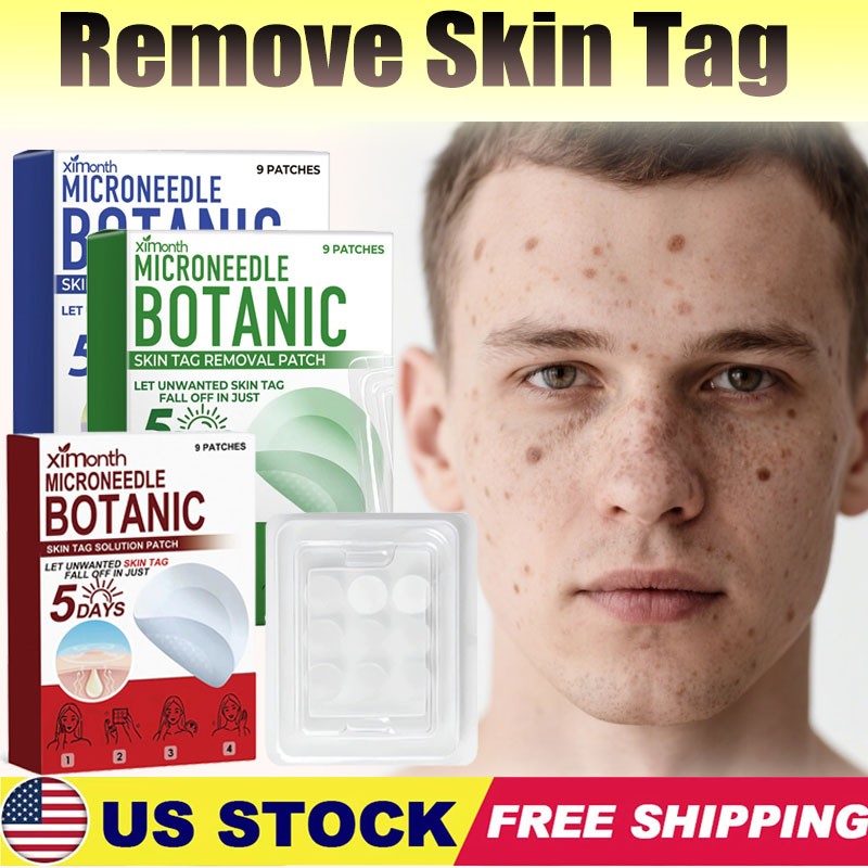 MICRONEEDLE BOTANIC Skin Tag & Acne Patch Skin Tag Remover Patches 9Pcs ...