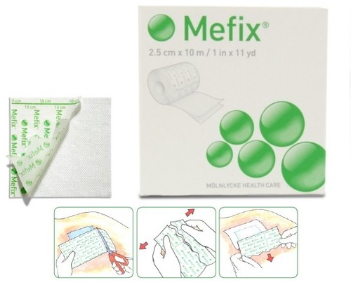 Mefix Tape - Self Adhesive Fabric Retention Tape | All Sizes | TRUSTED ...