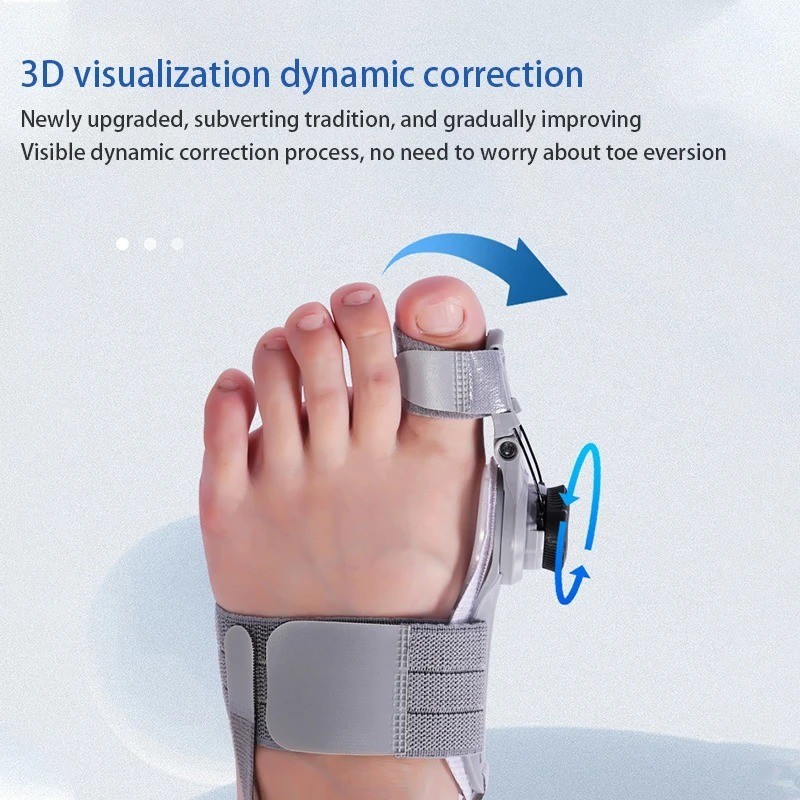 Treatmedy Bunion Fix Toe Valgus Corrector 2024 Foot Pain Relief Toe ...