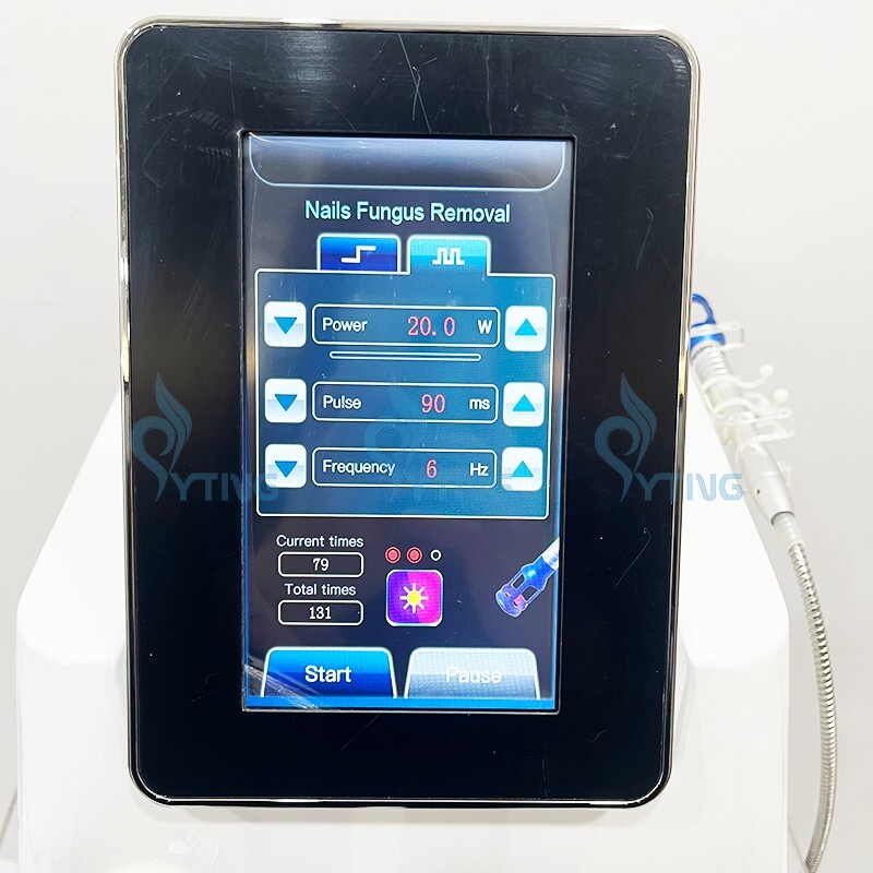 980nm Diode Laser Nail Fungus Removal Machine Toenail Infection ...