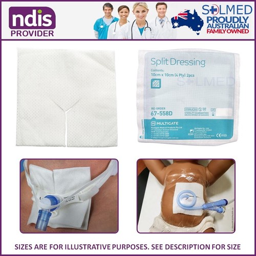 2 PACK SPLIT DRAINAGE DRESSING 10CM SPLIT DRESSING PEG DRESSING ...