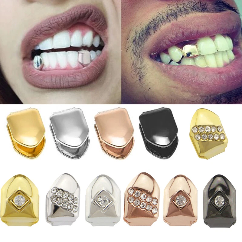 Custom Gold Teeth Grillz
