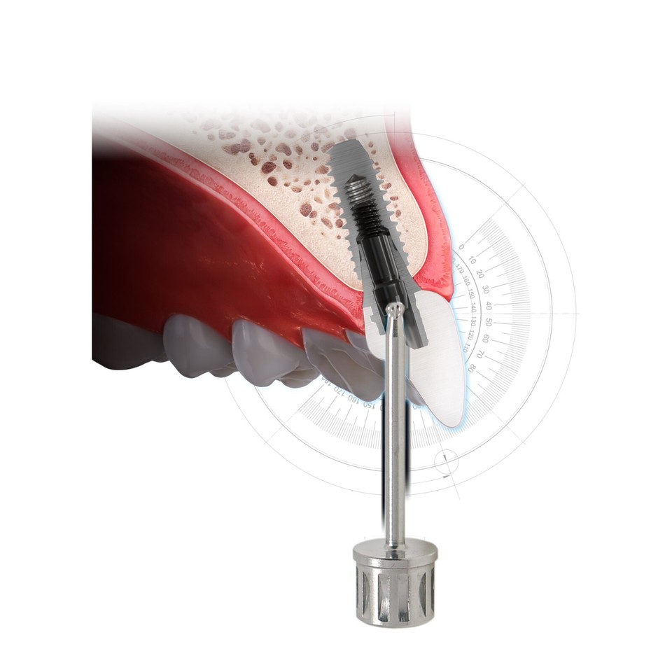 Straumann compatibl Implant Restoration Angled Torque Driver Tool For ...