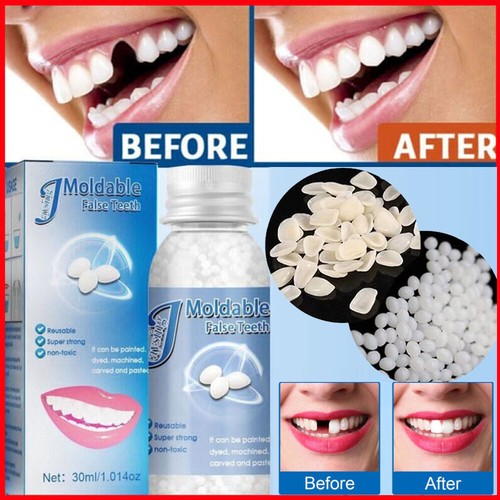 Tooth Repair Beads Granules Temporary Tooth Glue Reusable Moldable ...