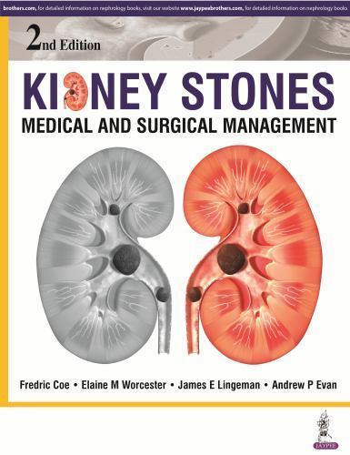 Kidney Stones : Medical and Surgical Management by Andrew P. Evan ...