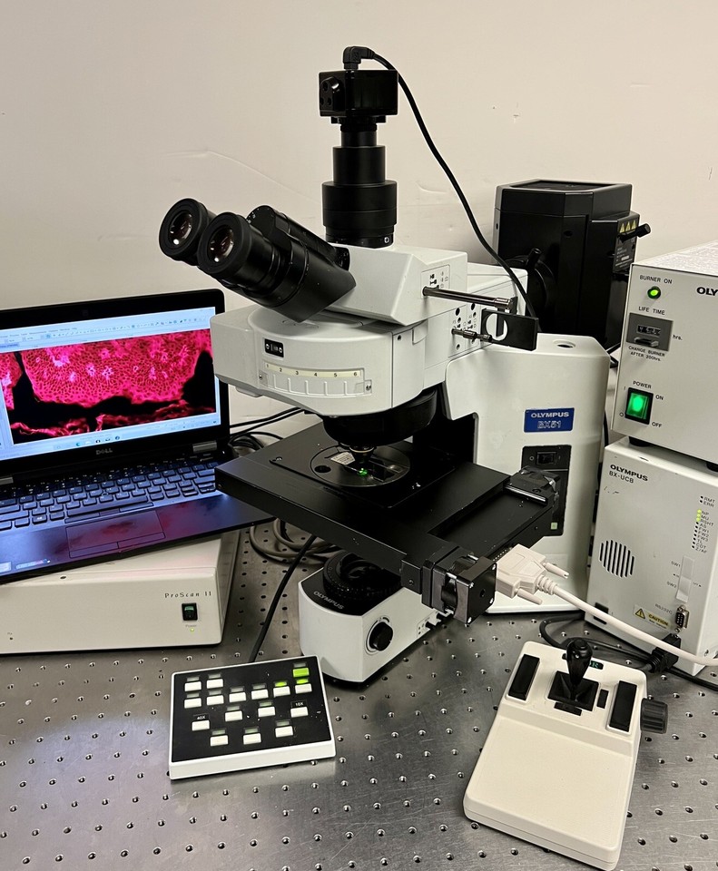 Olympus BX51 Fluorescence Prior Proscan 2 automated Scanning Microscope ...